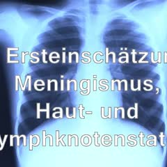 Meningismus - DocCheck Flexikon