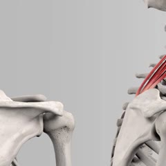 Scapula alata - DocCheck Flexikon
