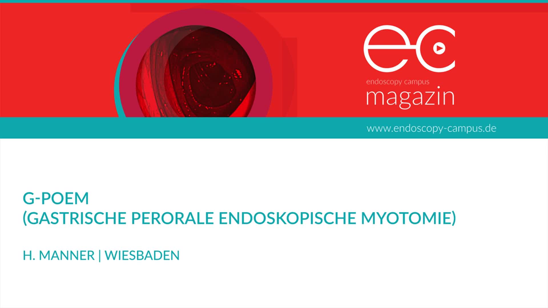 G-POEM - Gastrische Perorale Endoskopische Myotomie - DocCheck