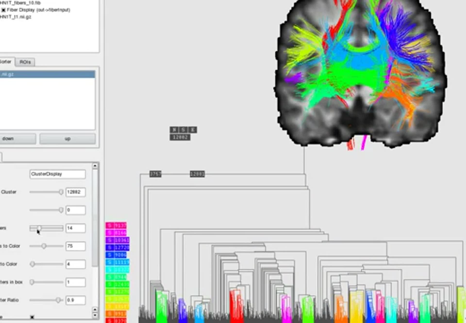 Navigation in clustered brain fiber tracts - DocCheck