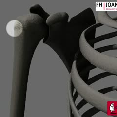 Locus minoris resistentiae - DocCheck Flexikon