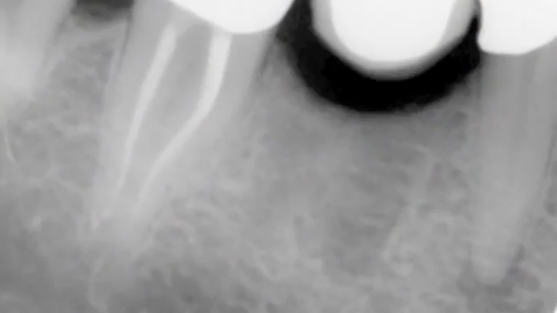 SAF - Hybrid Protocol - Dr. Tomas Lang - DocCheck