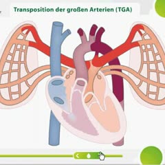 TGA - DocCheck Flexikon