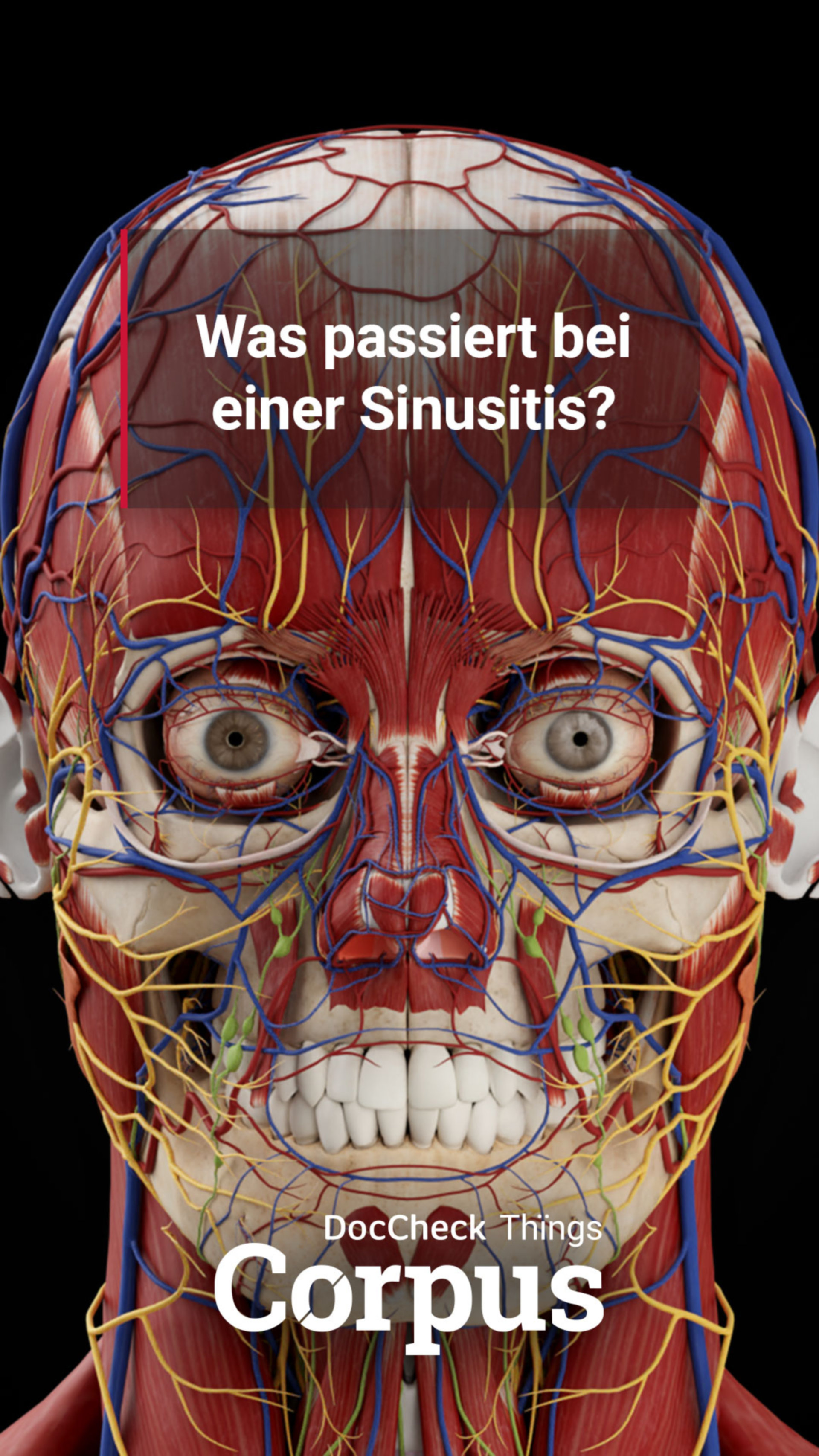Anatomie zum Anfassen: Sinusitis - DocCheck