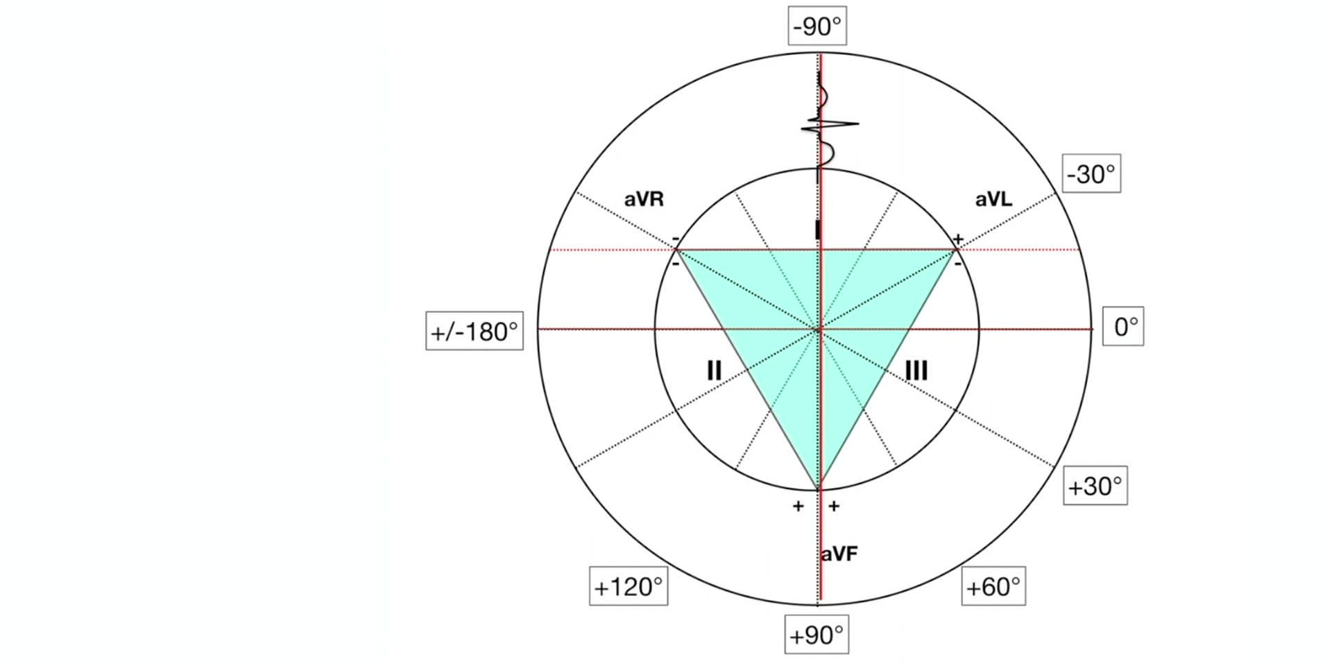 Themenwoche EKG: Lagebestimmung mittels Cabrerakreis - DocCheck