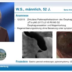 Pyloromyotomie - DocCheck Flexikon