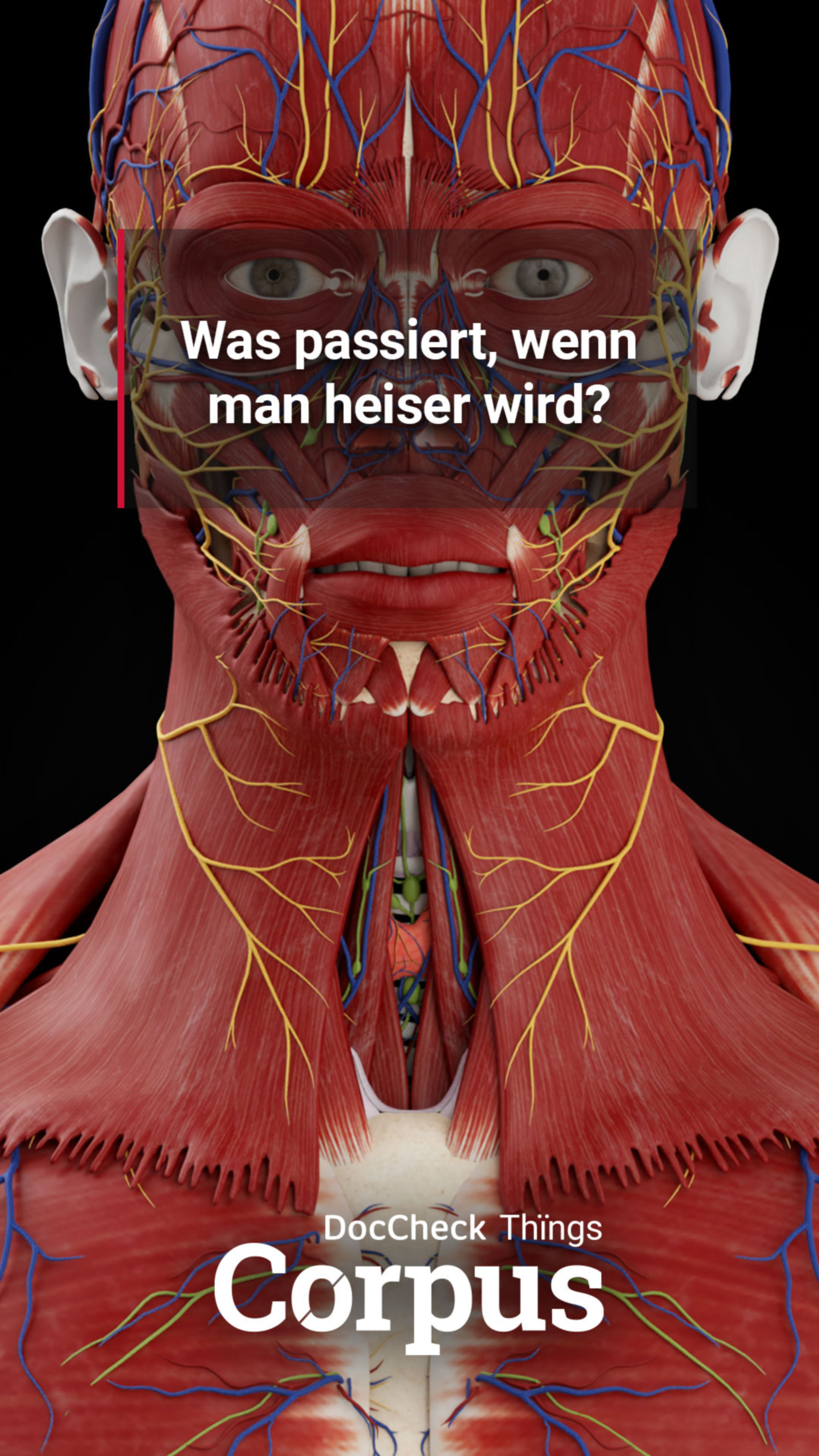 Anatomie zum Anfassen: Heiserkeit - DocCheck