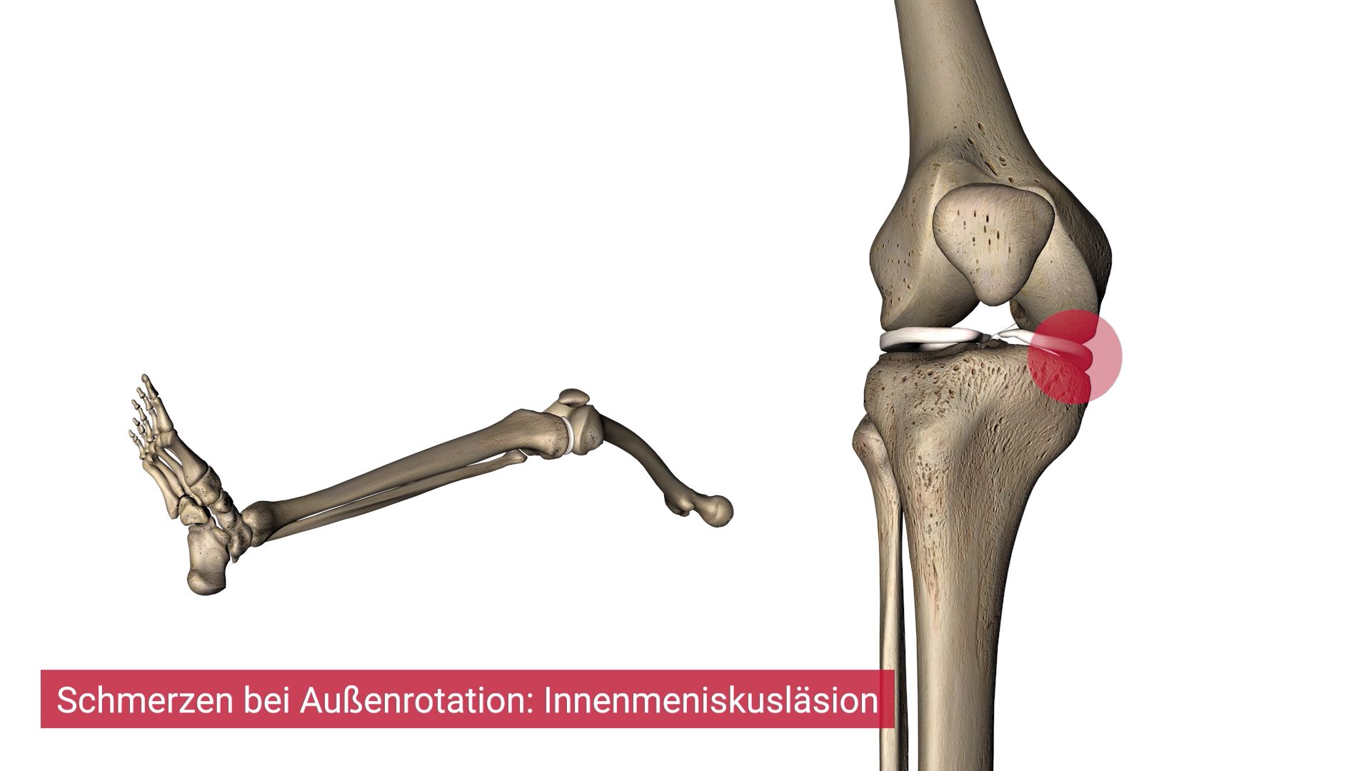 HowTo: Bragard-Test - DocCheck