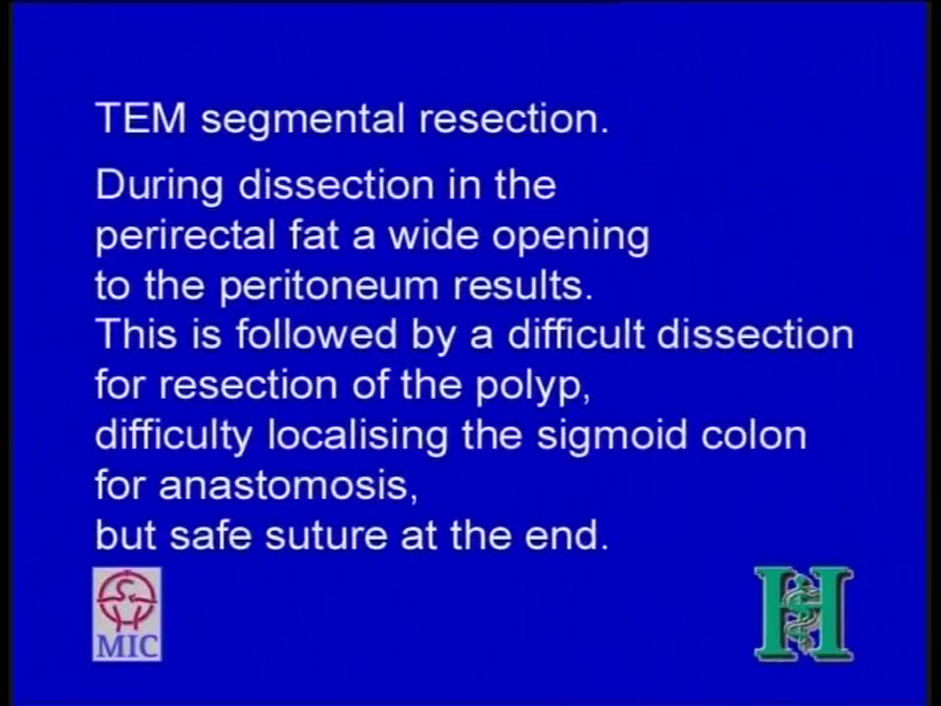 Transanal endoscopic Microsurgery (TEM), Part 09 - DocCheck