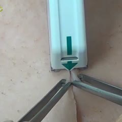 Wundrand - DocCheck Flexikon