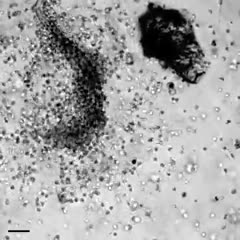 Leukotrien - DocCheck Flexikon