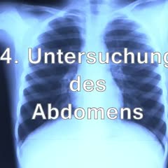 Appendizitiszeichen - DocCheck Flexikon