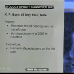 Stapes - DocCheck Flexikon