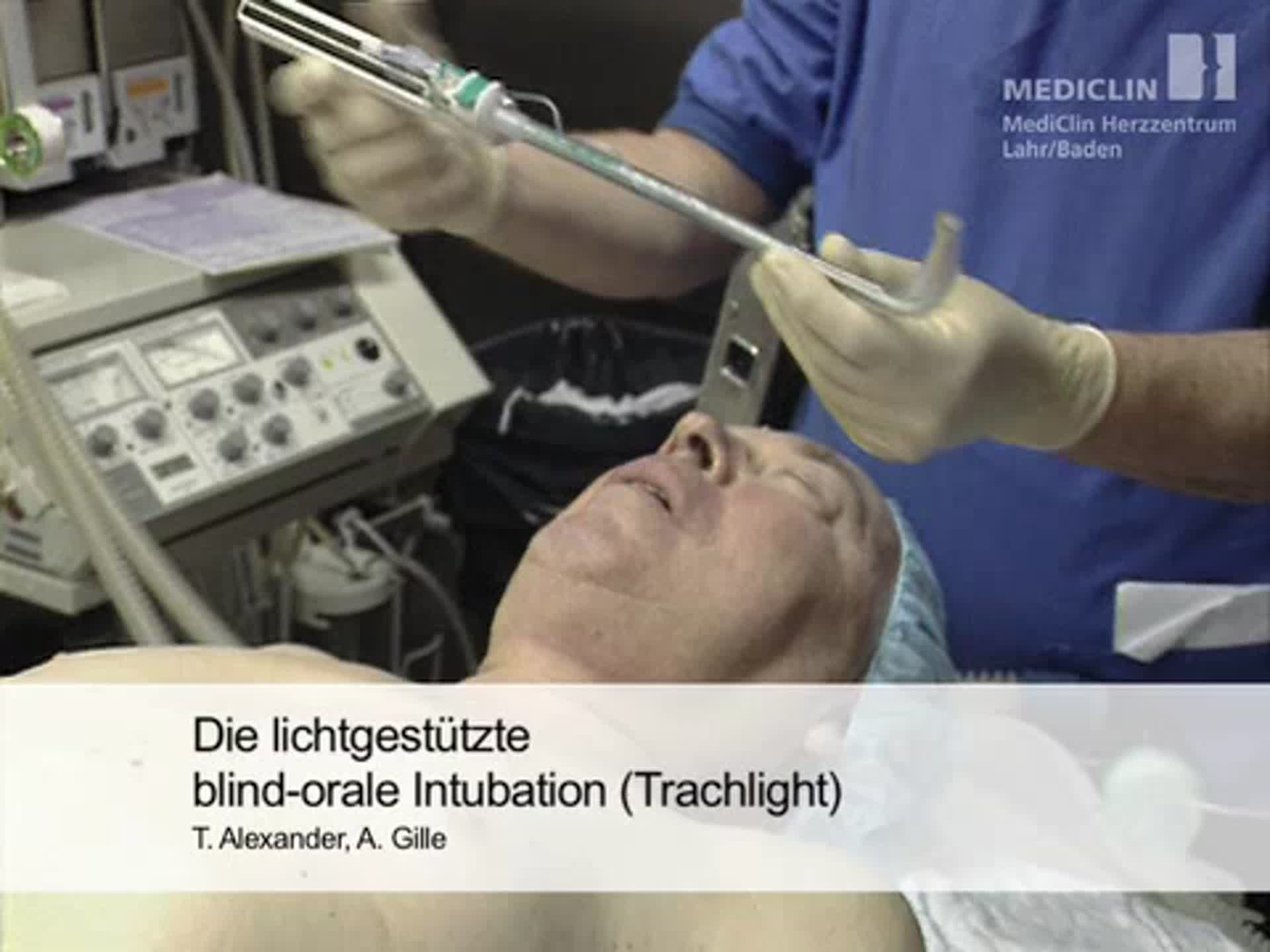 Lichtgestützte blind-orale Intubation (Trachlight) - DocCheck
