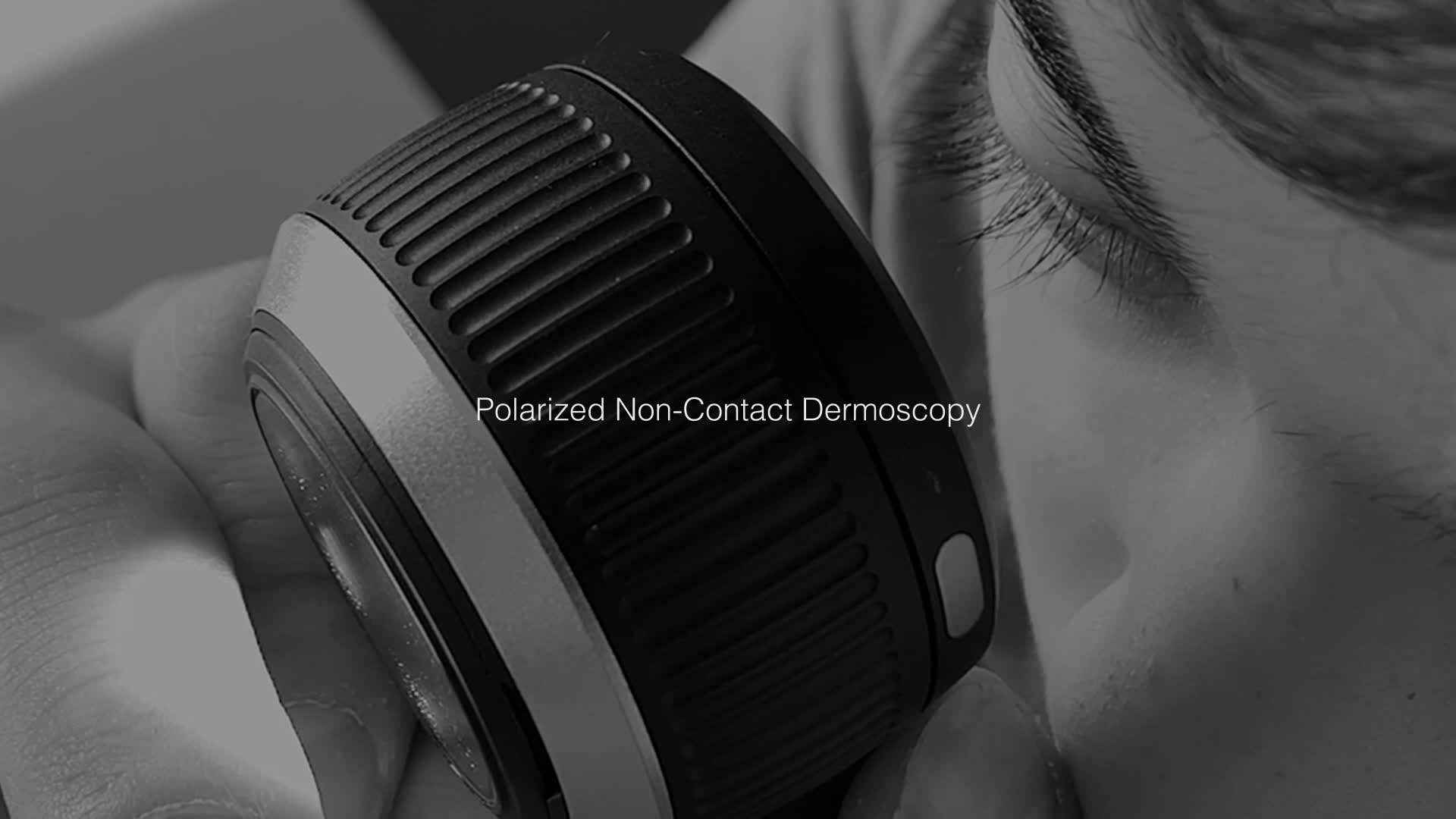 DermLite DL4 Dermatoskop - DocCheck