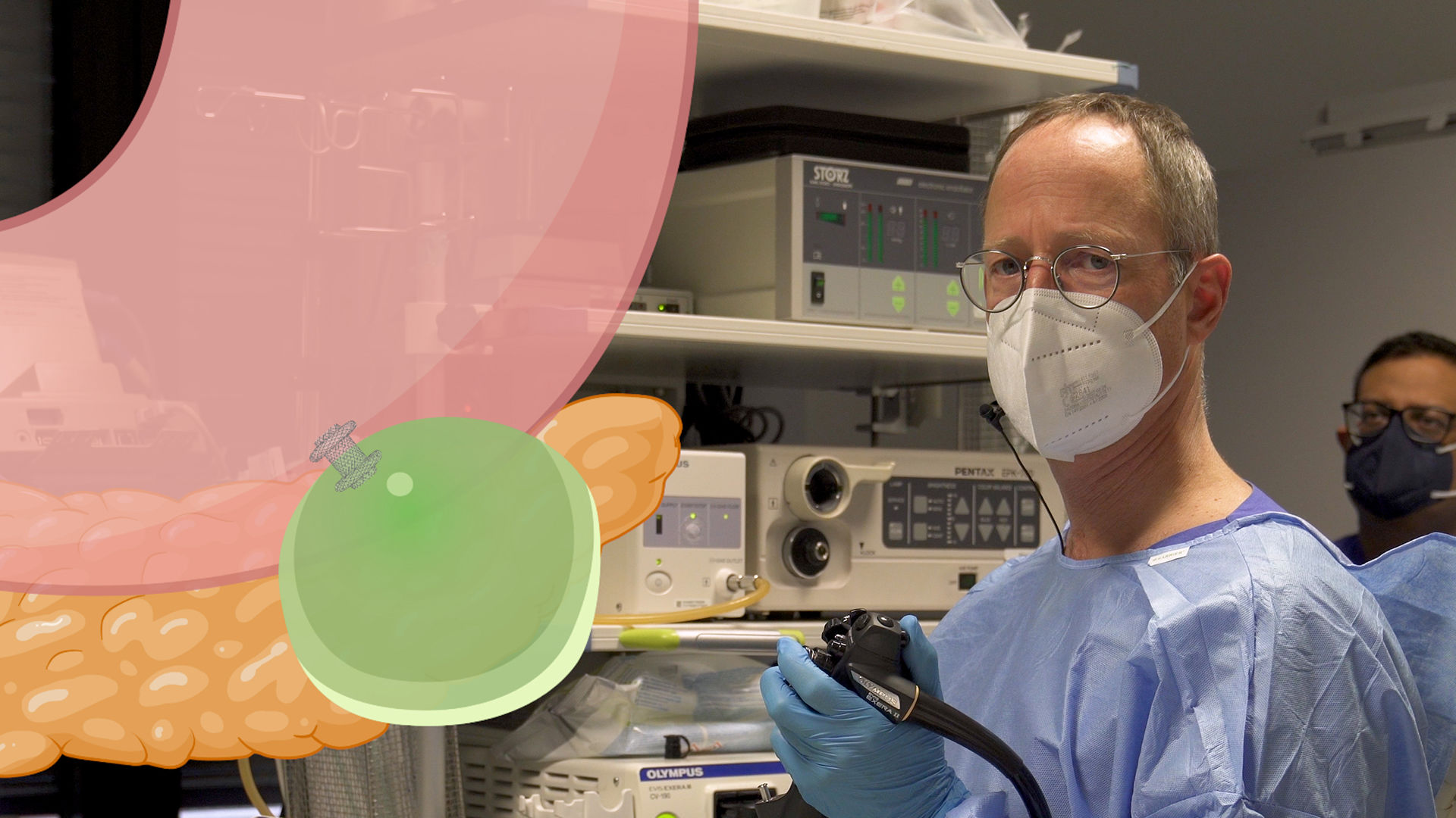 Lumen-Apposing Metal Stent: So geht's - DocCheck