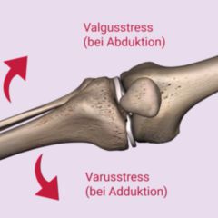 Gowers-Zeichen - DocCheck Flexikon